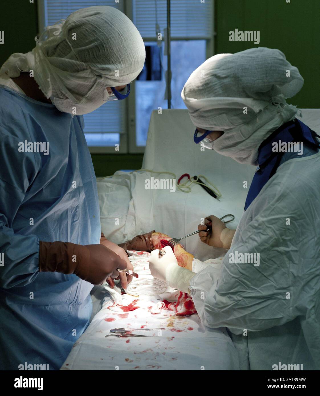 Forearm bones hi-res stock photography and images - Alamy