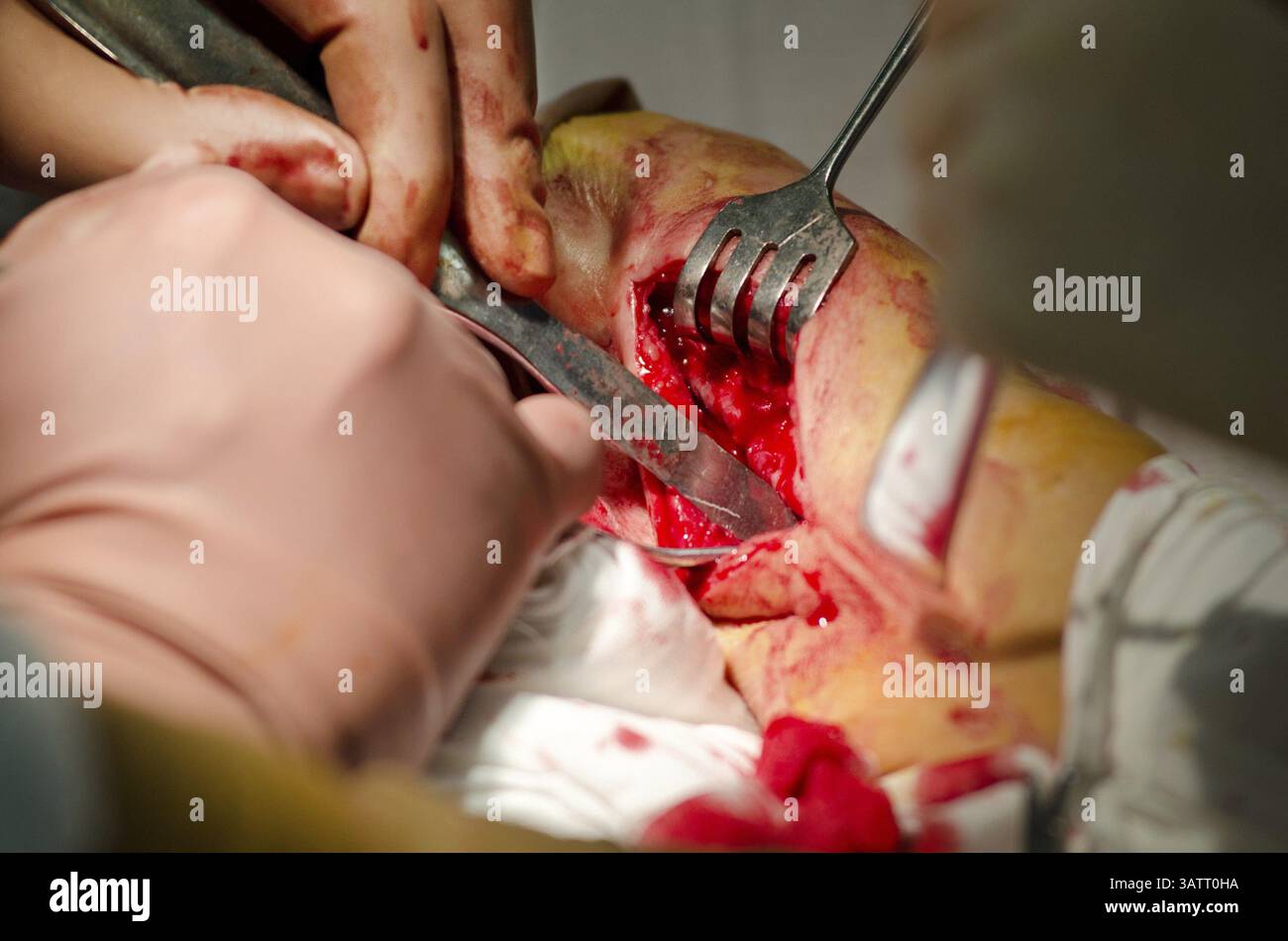 Forearm bones hi-res stock photography and images - Alamy