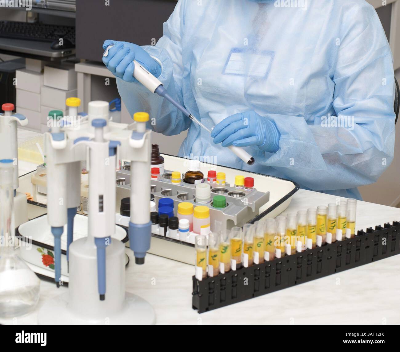 Nurse makes analysis of a blood sample at a laboratory Stock Photo - Alamy