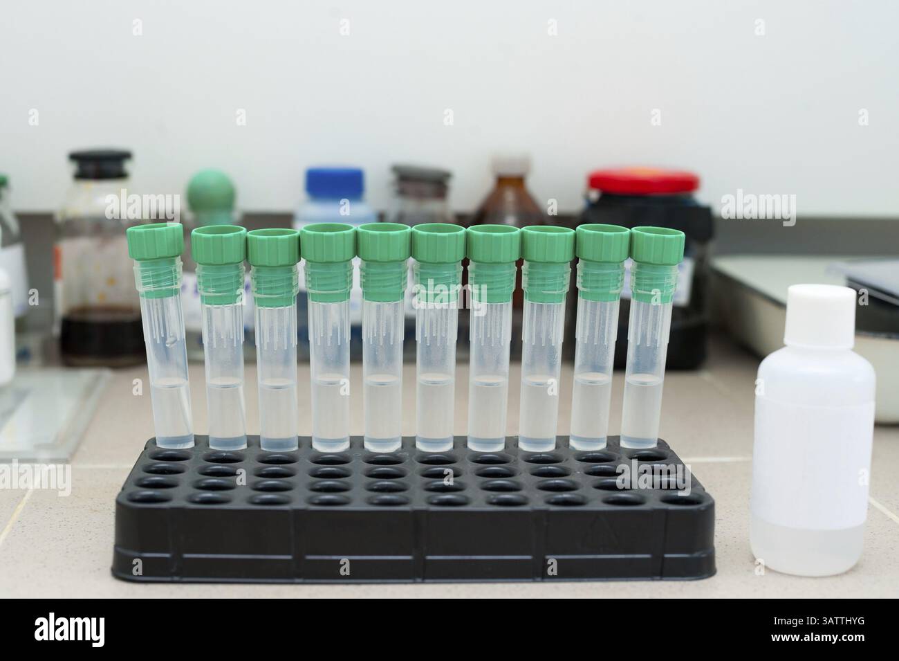 At a clinic laboratory - test tubes with reagent ready for analysis ...