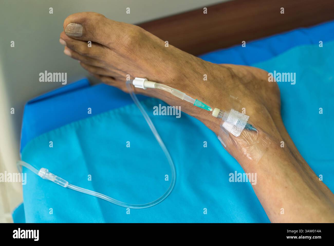 Patient asian elder man 80s with saline intravenous at C-line or A-line ...