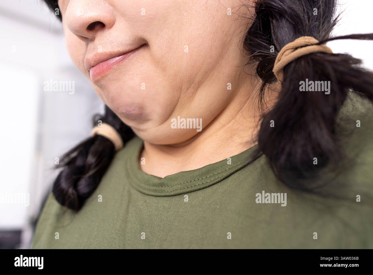 fat woman with double chin Stock Photo - Alamy