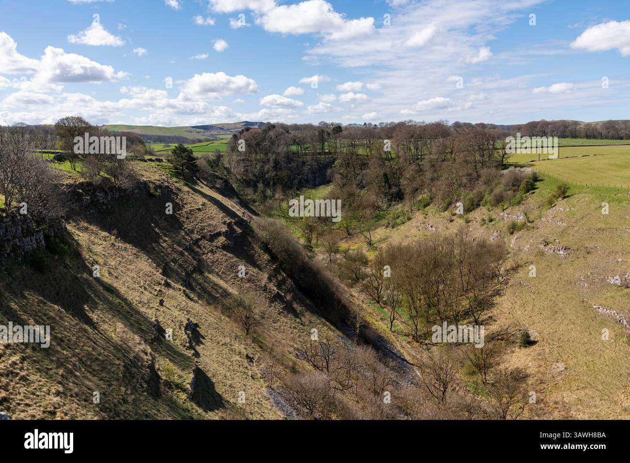 Deep Dale near Buxton, Peak District, Derbyshire, England Stock Photo ...