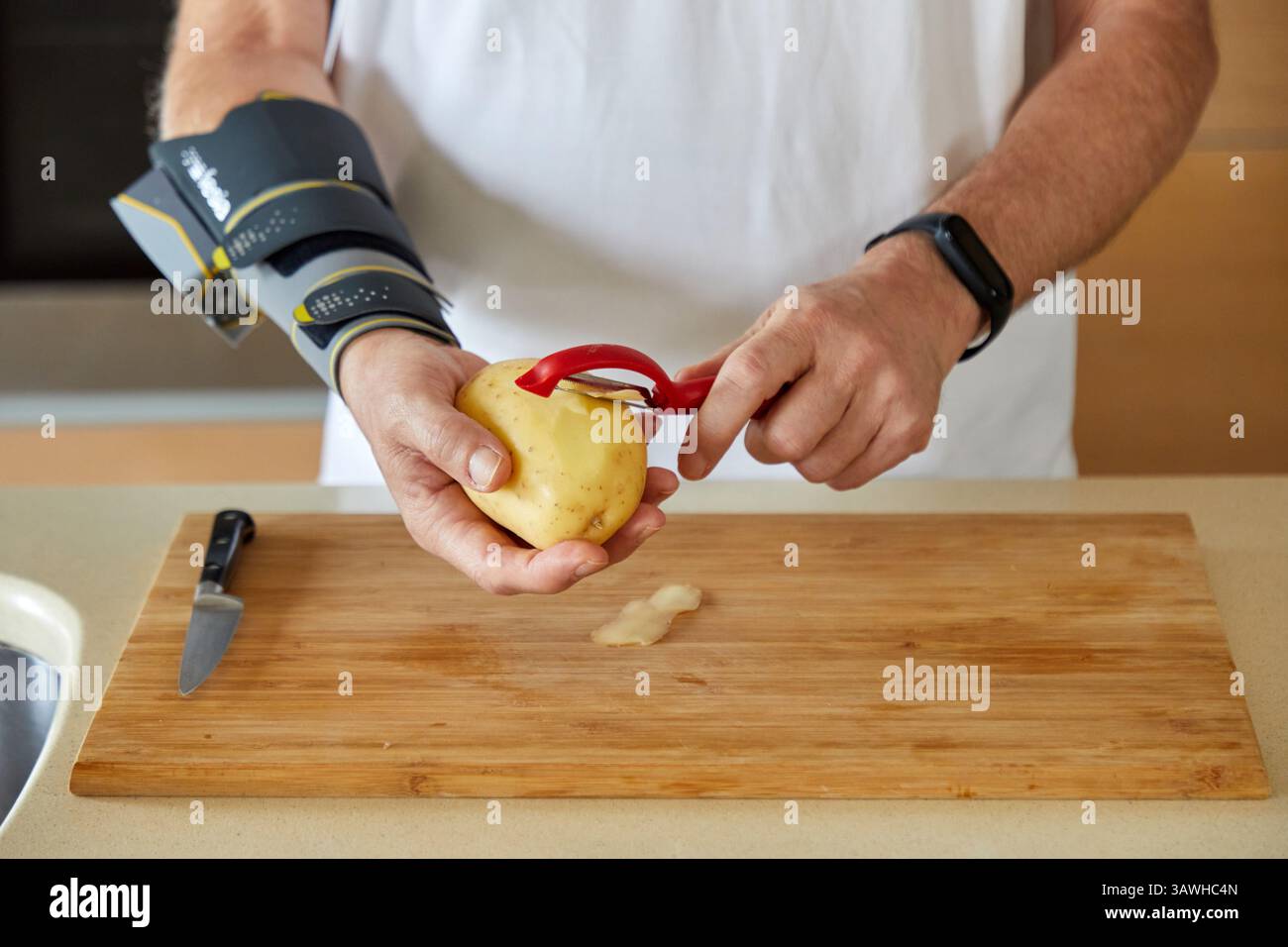 The Rehabilitation Device Based On Functional Electrical Stimulation Fes That Generates