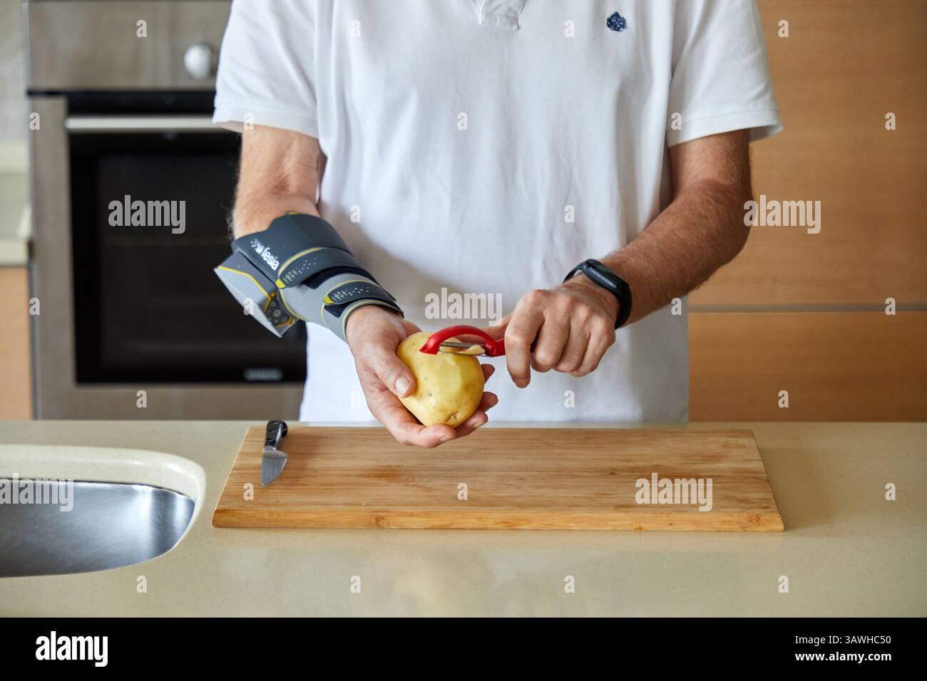 The rehabilitation device based on functional electrical stimulation ...