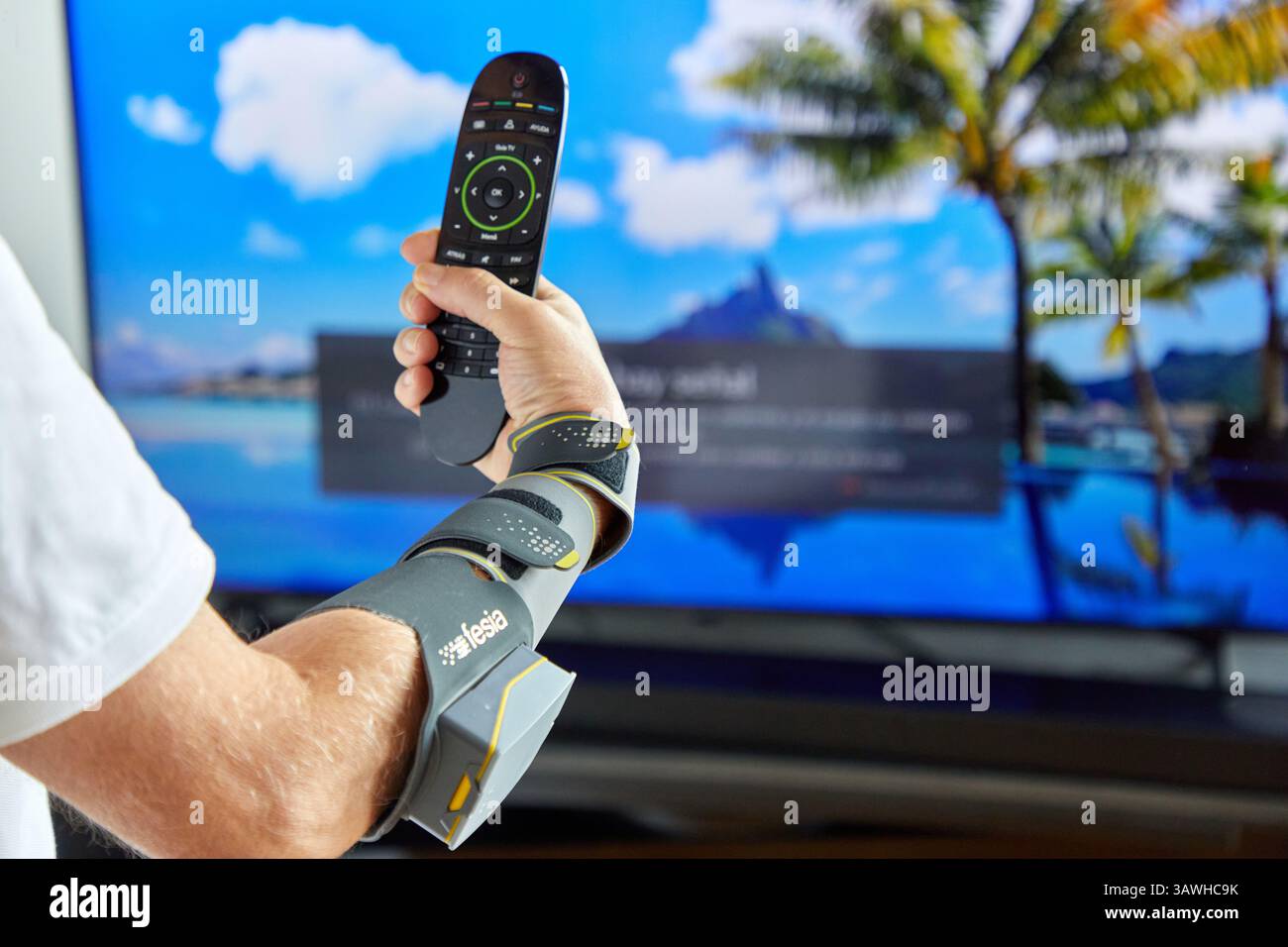 The Rehabilitation Device Based On Functional Electrical Stimulation Fes That Generates