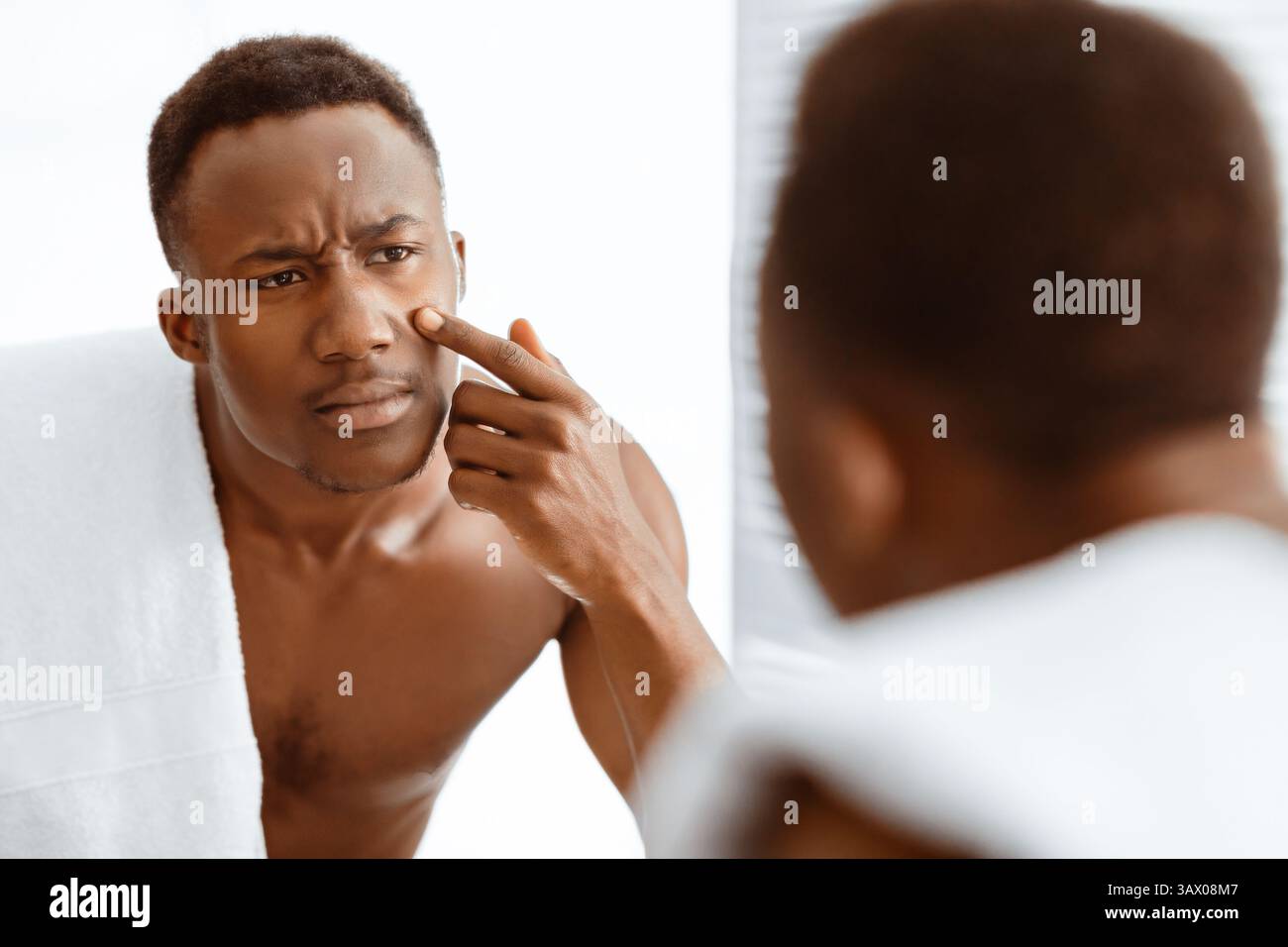 African Man Touching Acne Pimple On Face Standing In Bathroom Stock ...