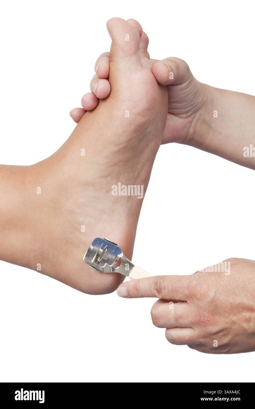 Callus removal on a female foot - cut-out Stock Photo - Alamy