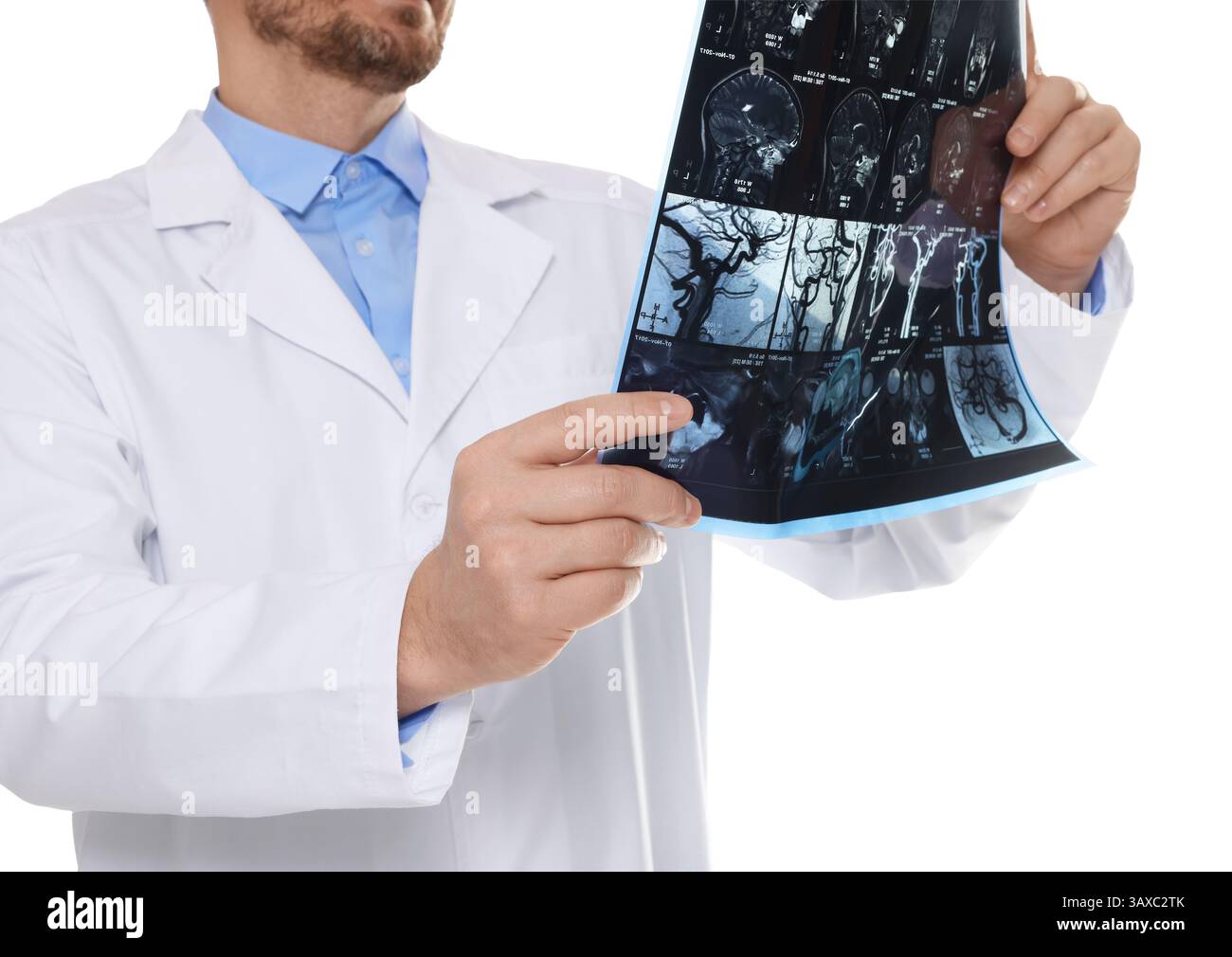 Doctor examining brain MRI scan in clinic on white background, closeup ...