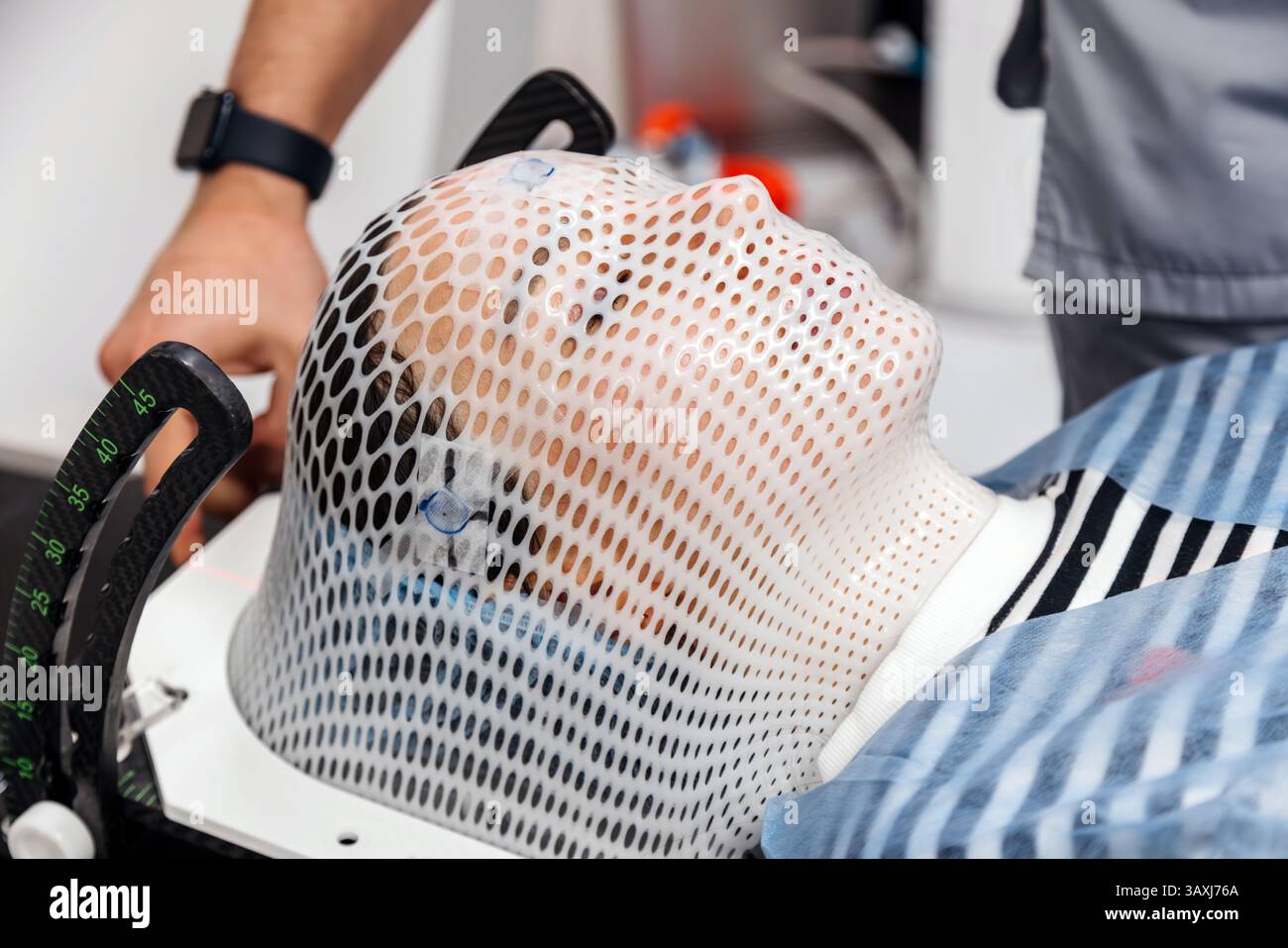 Close-up of markings attached to the immobilization mask for accurate ...