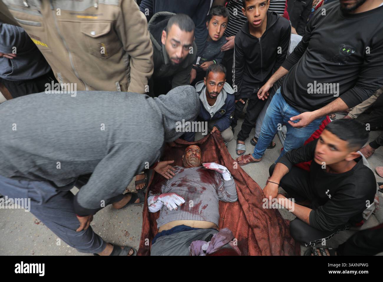 Wounded people, including children are brought to Al-Awda Hospital in ...