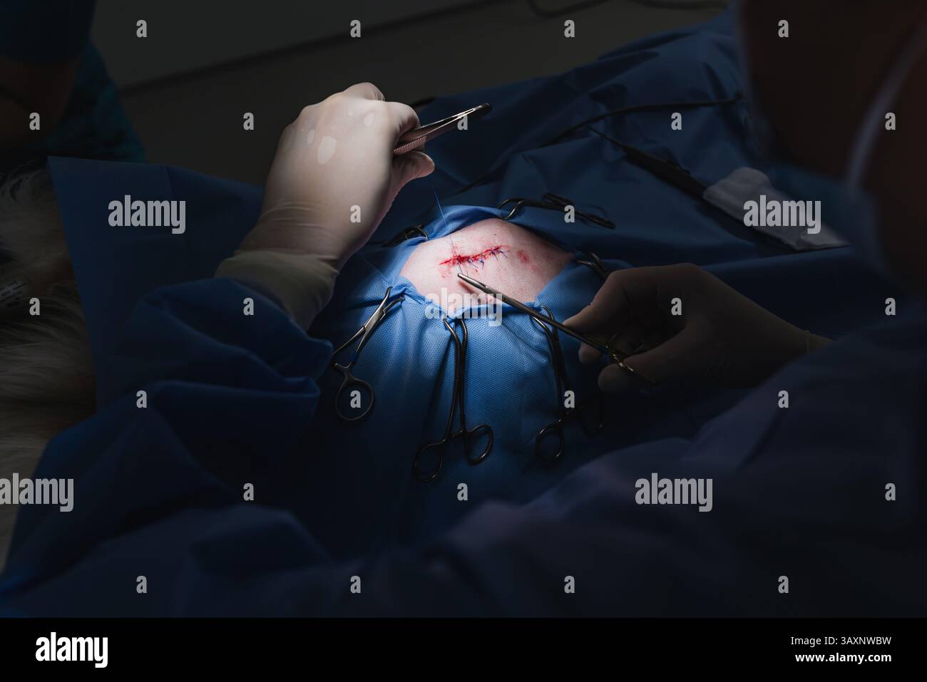 Female veterinarian performing surgery on a patient animal, stitching ...