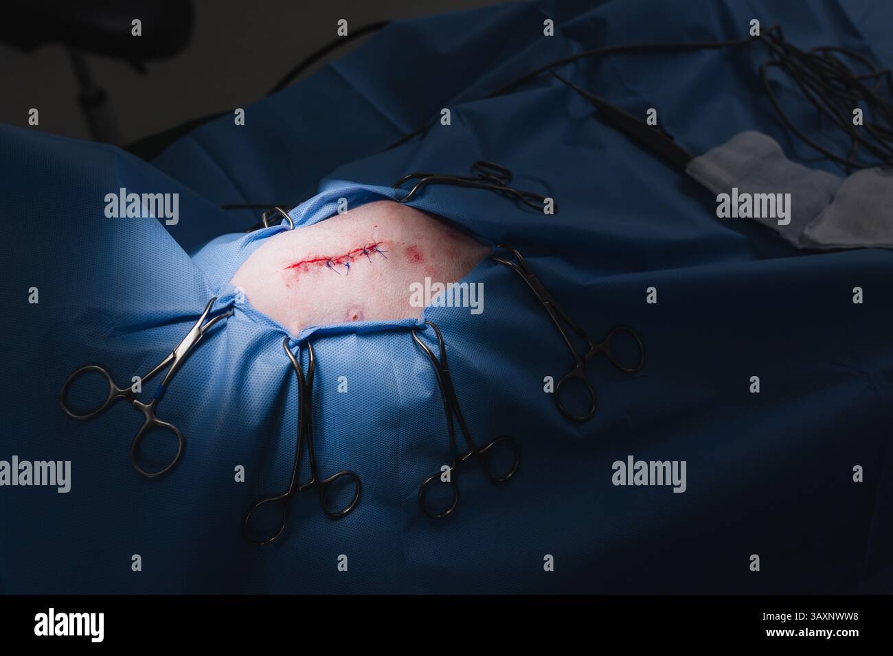Vet woman suturing surgical wound of a dog under anesthesia after ...