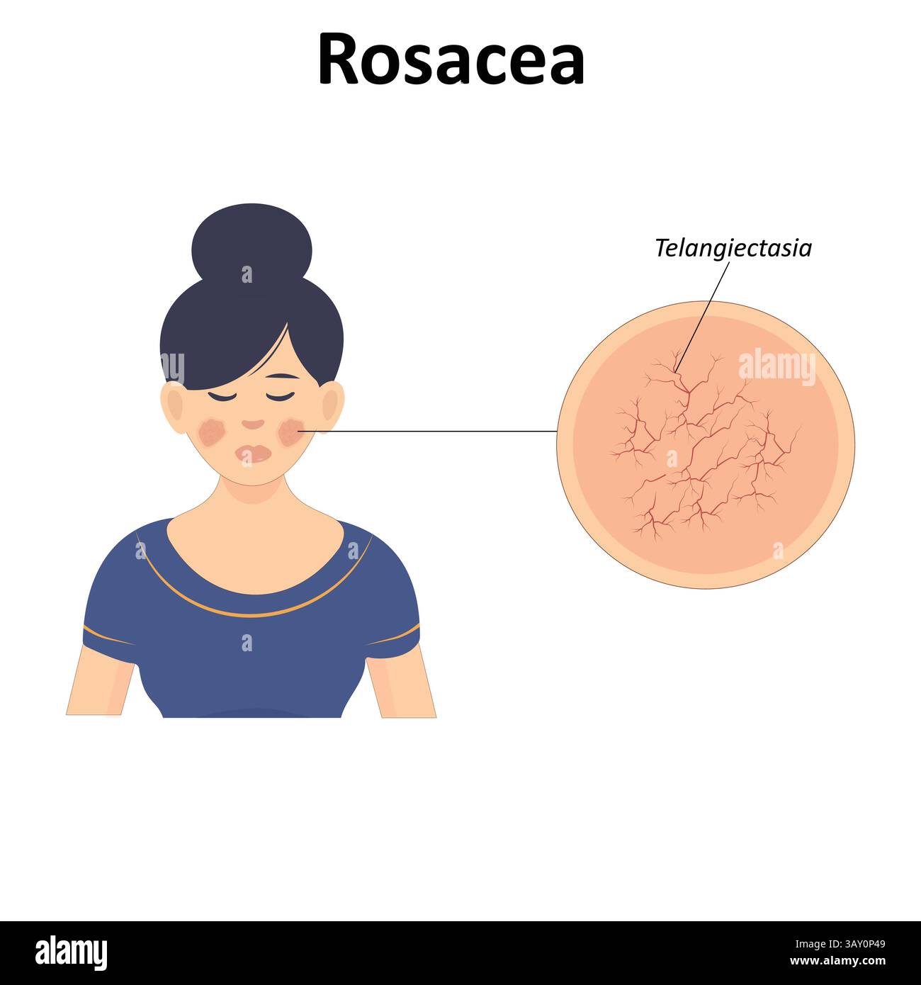 No skin disease Cut Out Stock Images & Pictures - Alamy