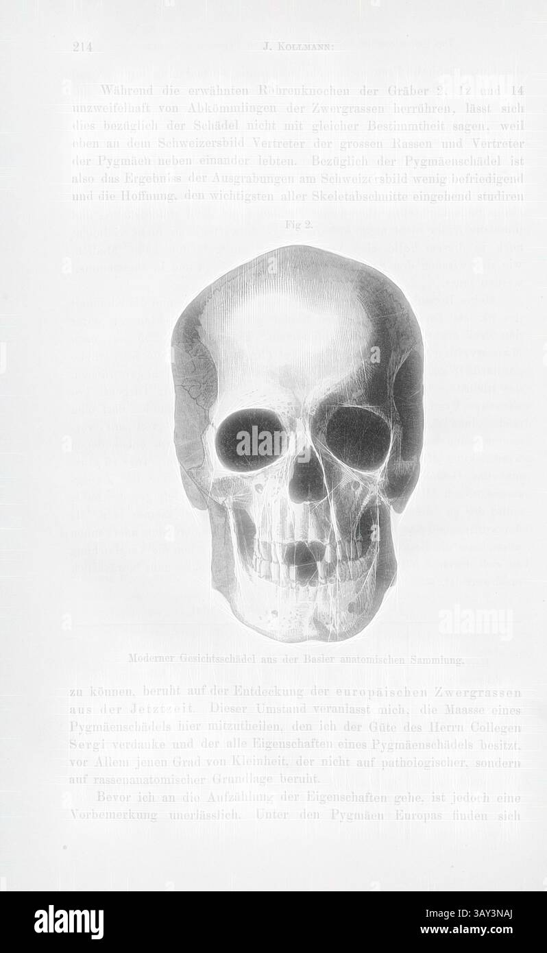 A detailed illustration of a human skull, showcasing its anatomical ...