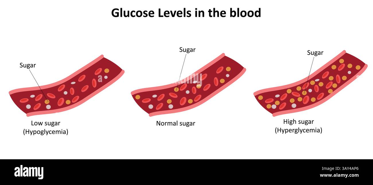 Glucose levels in the blood vector illustration Stock Vector Image ...