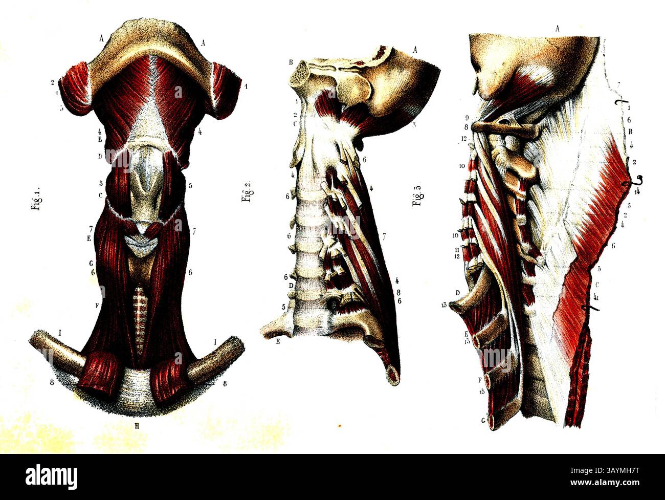 Neck and prevertebral muscles, 1866 illustration. Plate from 'Atlas d ...