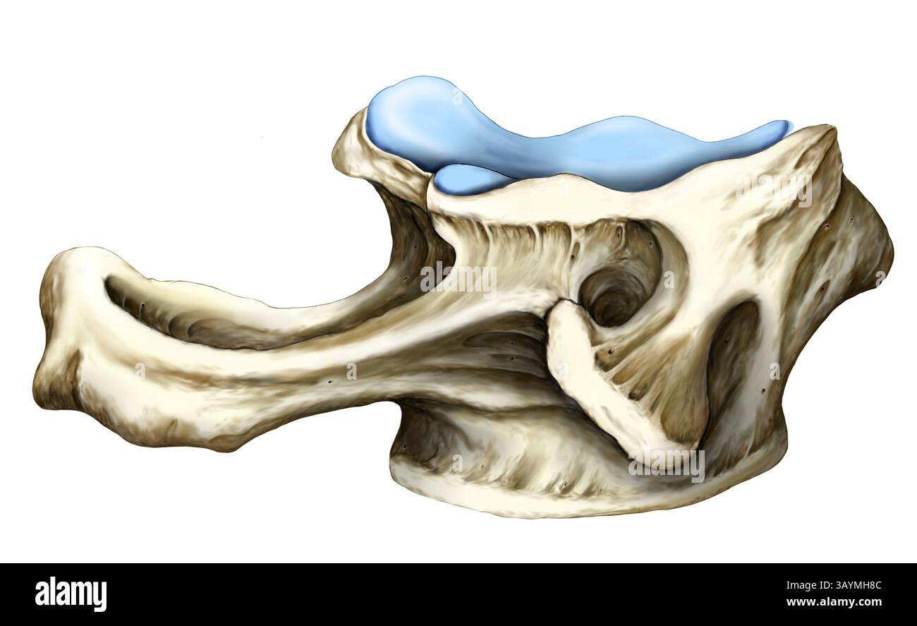 Illustration of the atlas (C1 vertebra) from a lateral perspective. As ...