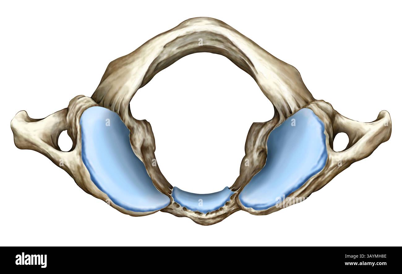 Illustration of the atlas (C1 vertebra) from a caudal perspective. The ...