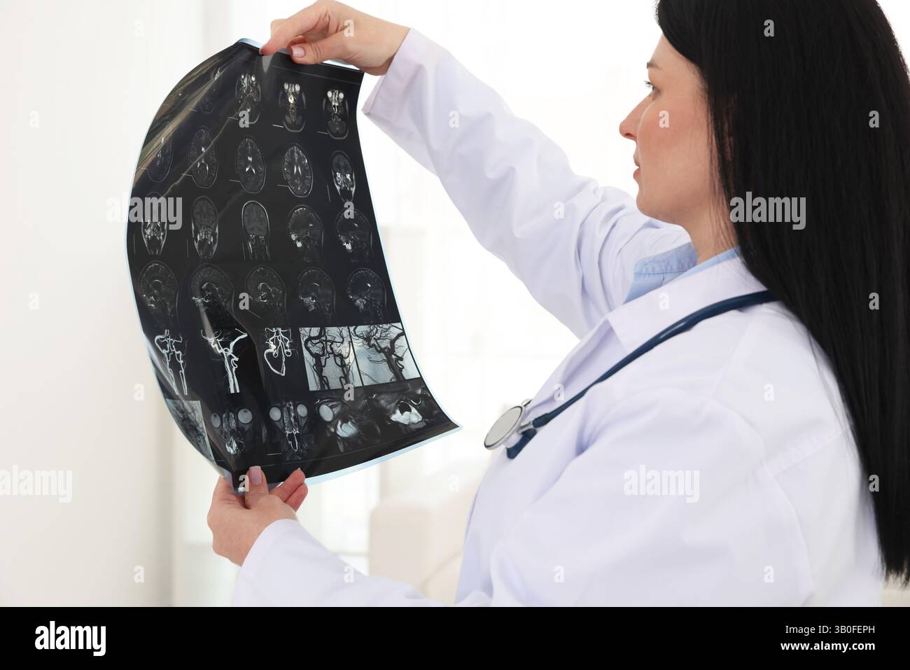Doctor examining brain MRI scan in clinic Stock Photo - Alamy