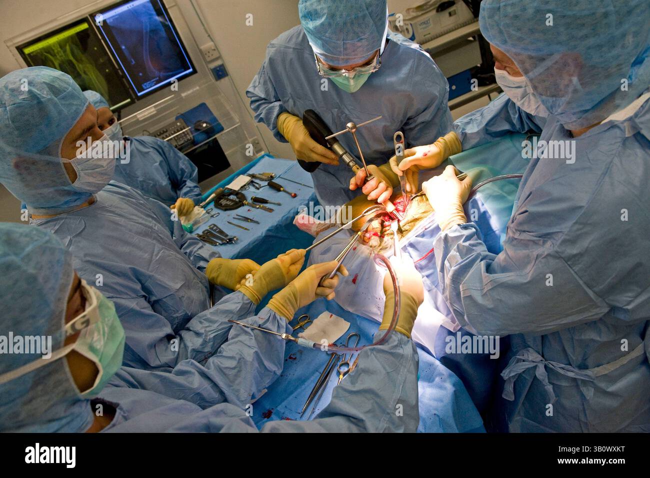 Hip replacement surgery in operating theatre hi-res stock photography ...