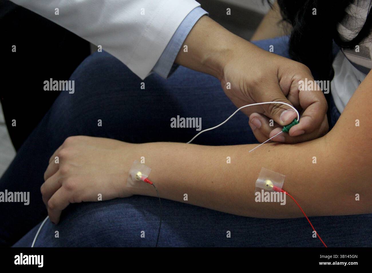 Electromyography and somatosensory evoked potentials are ...
