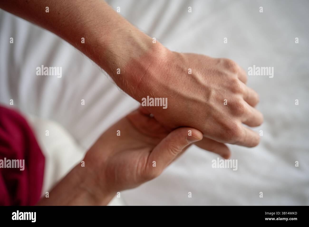 Man hand with sun burn left the mark on wrist watch. Male showing ...