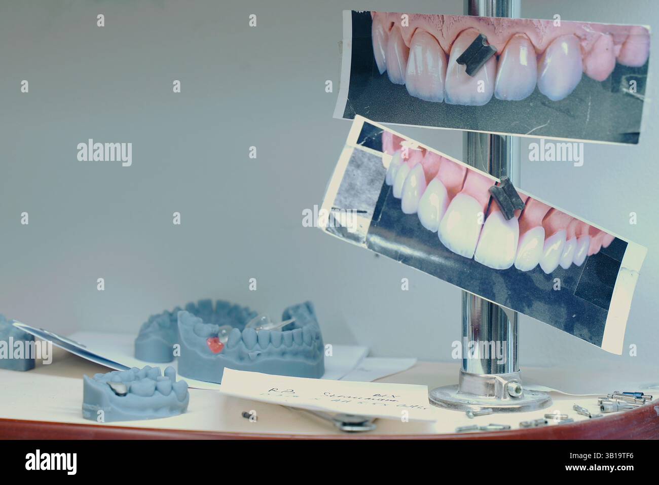 A dental workspace displays models of teeth alongside photographs of ...