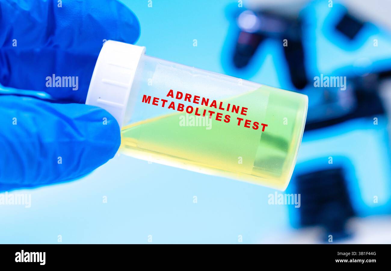 Adrenal function test urine test. Detects adrenaline byproducts to ...
