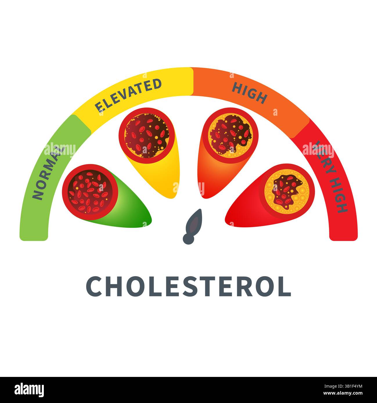 Cholesterol meter test level hi-res stock photography and images - Alamy
