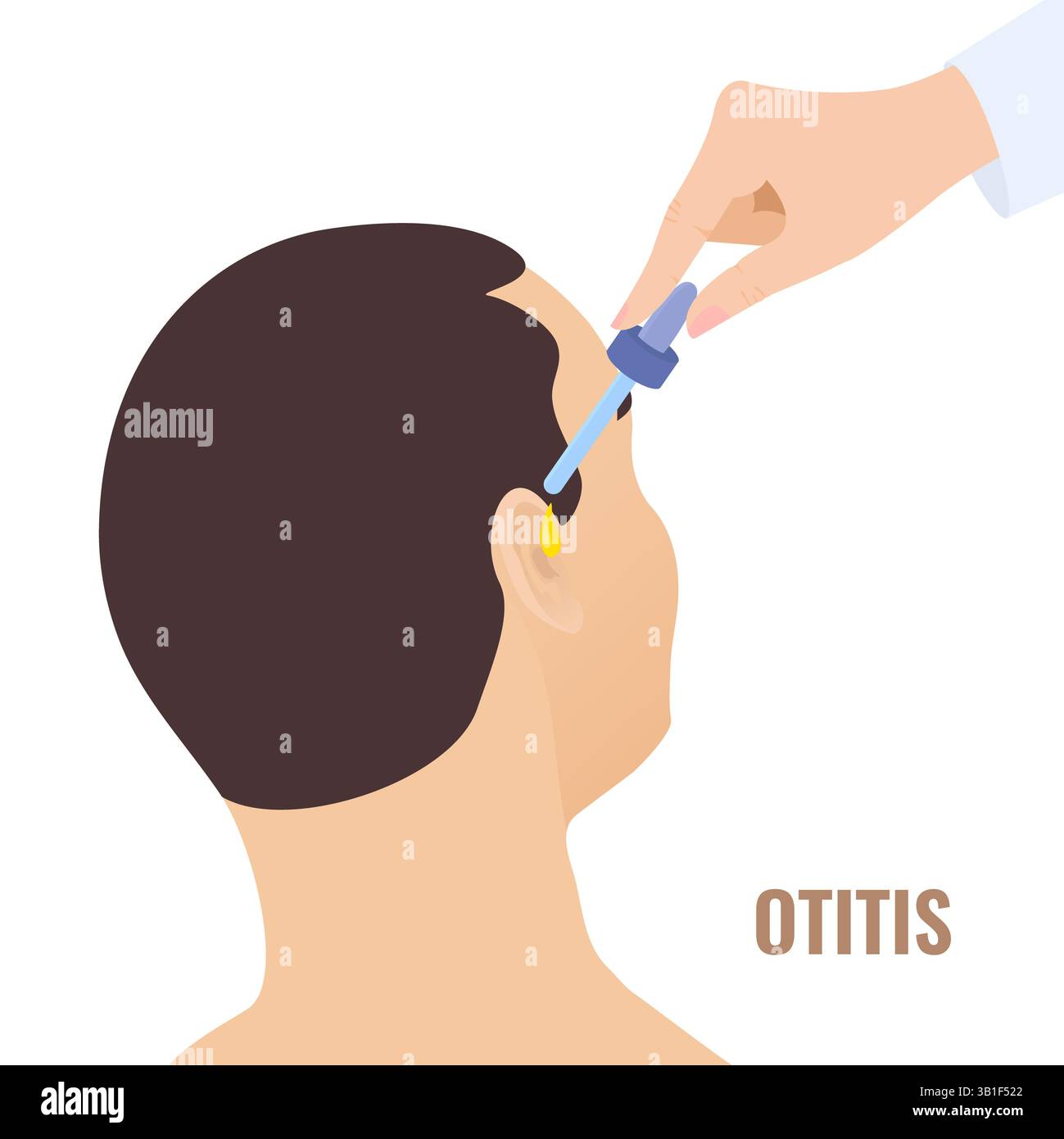 Ear treatment, illustration Stock Photo - Alamy