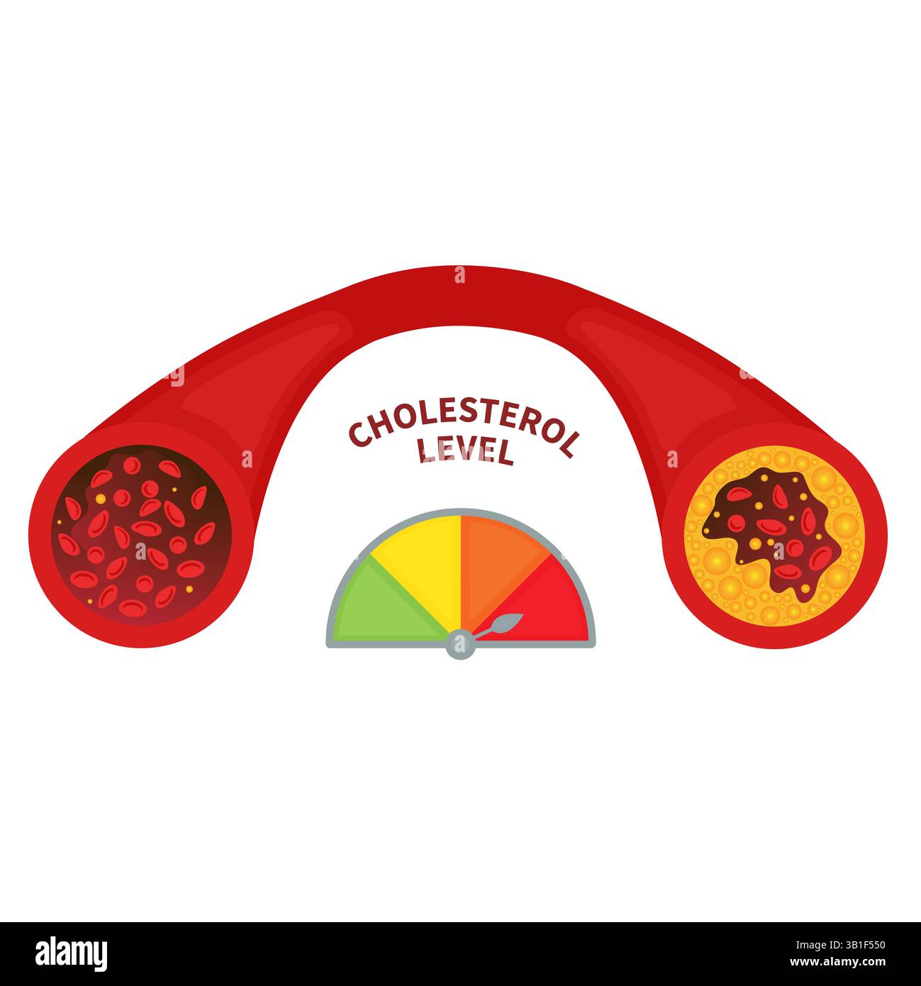 Cholesterol level, conceptual illustration. Meter gauge of LDL and HPL lipoprotein. High and low ...