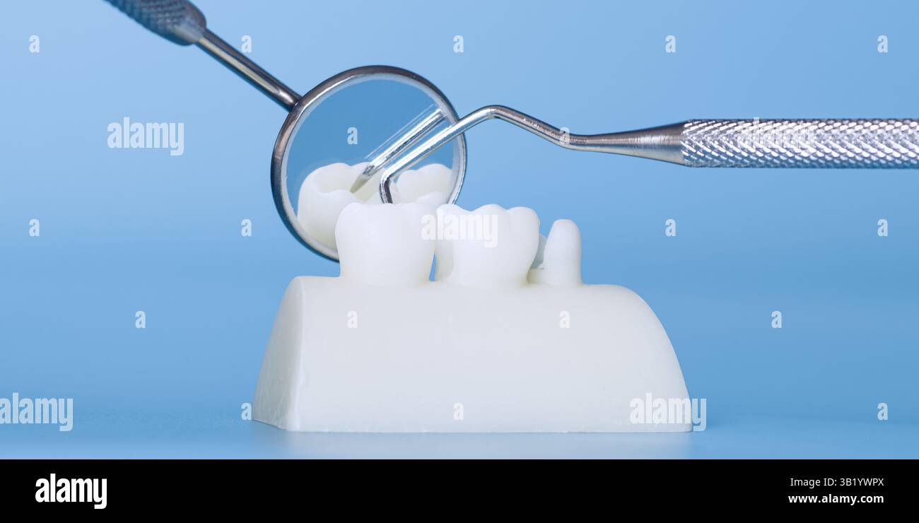 Dental bridge model with examination Stock Photo - Alamy