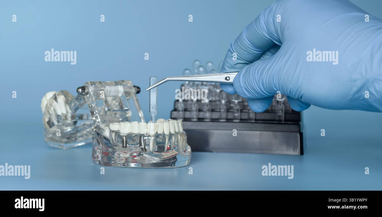 Dental model veneer shade hi-res stock photography and images - Alamy