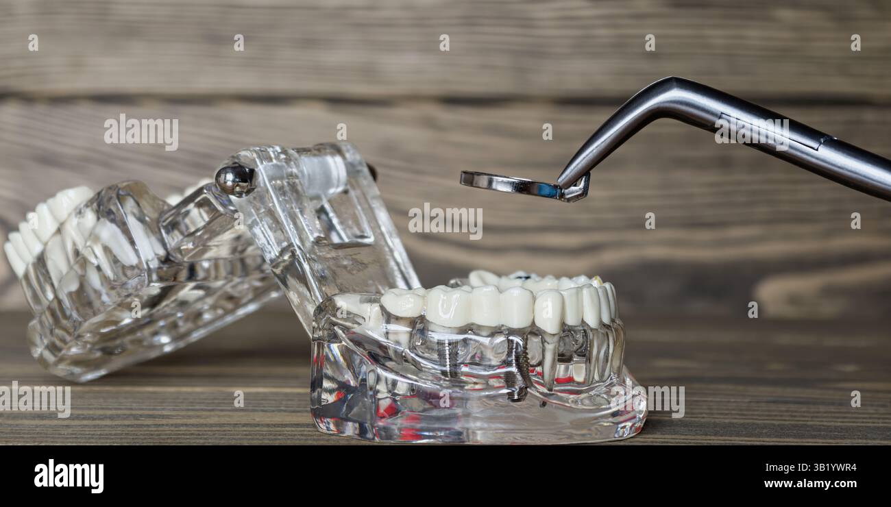 Dental root canal model with metal inspection Stock Photo - Alamy