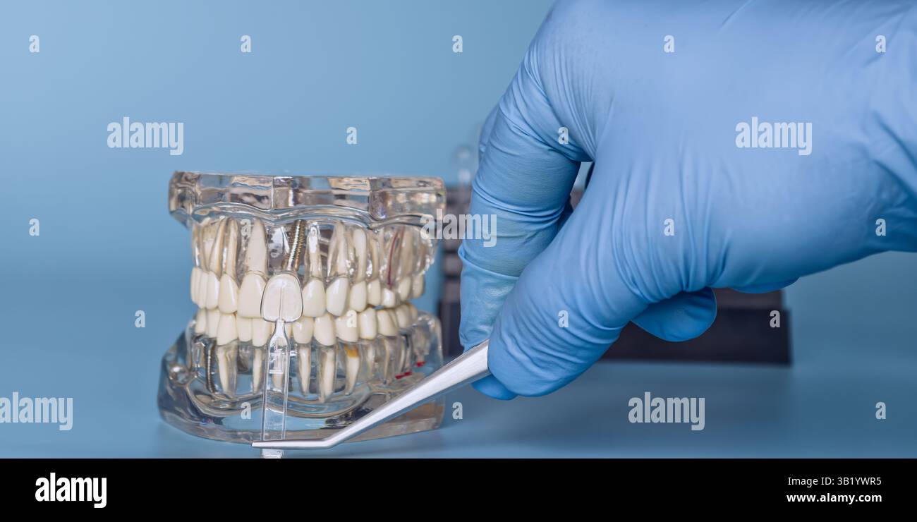 Model of teeth with sample size and hand Stock Photo - Alamy