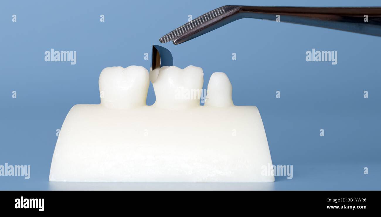 Dental sectional matrix contour system installation on a dummy on a ...