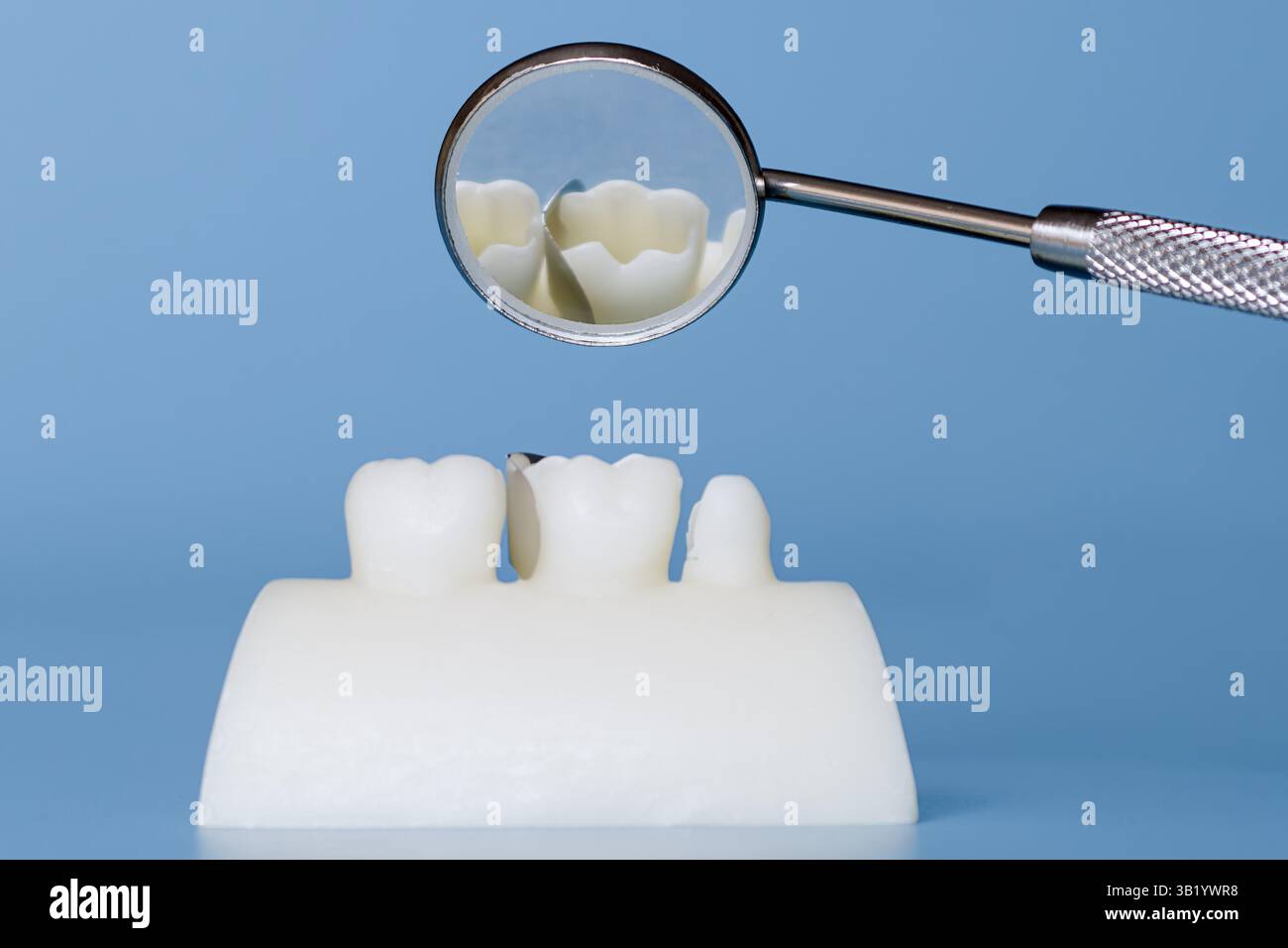 Dental sectional matrix contour system Stock Photo - Alamy