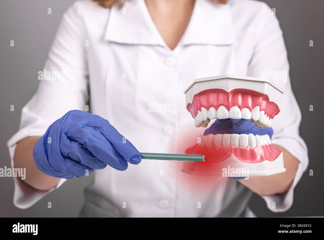 Gum inflammation. Woman with painful red gingiva pointing to mouth ...