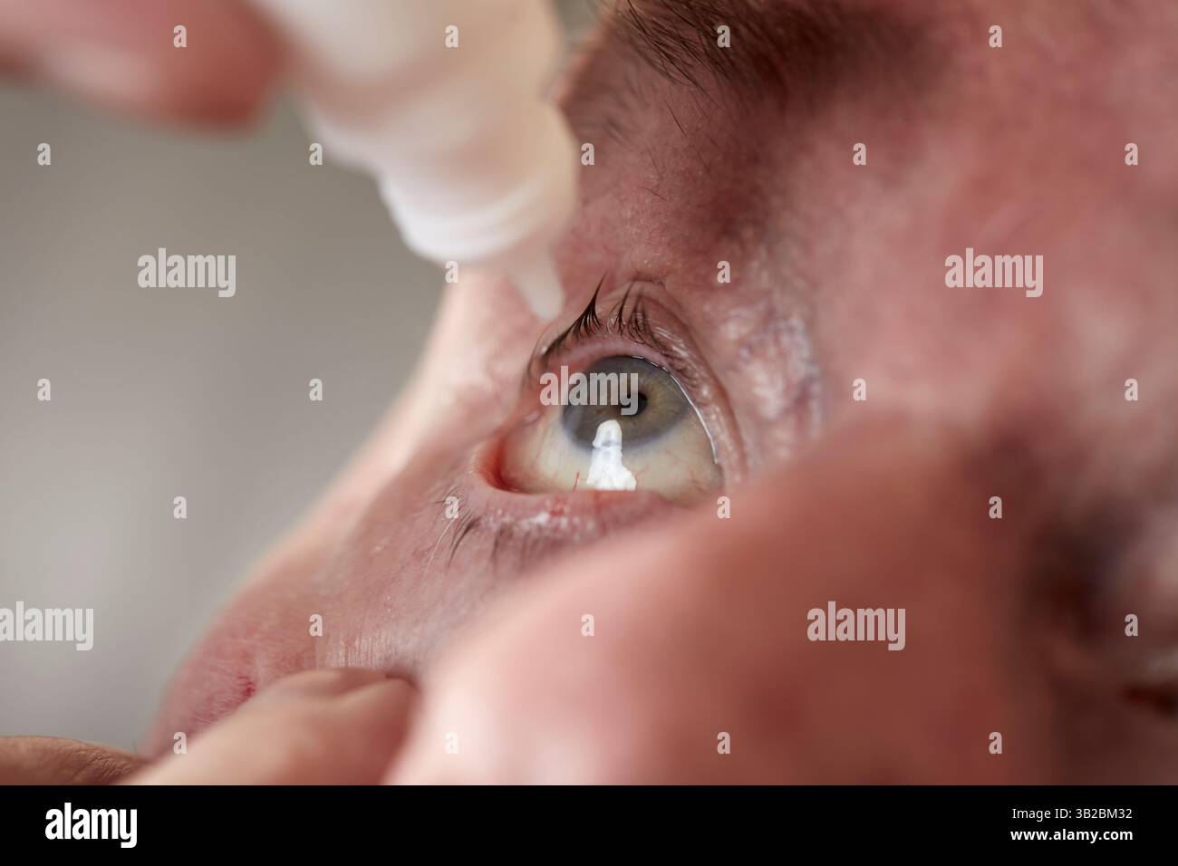 An elderly man administering eye drops to himself Stock Photo - Alamy