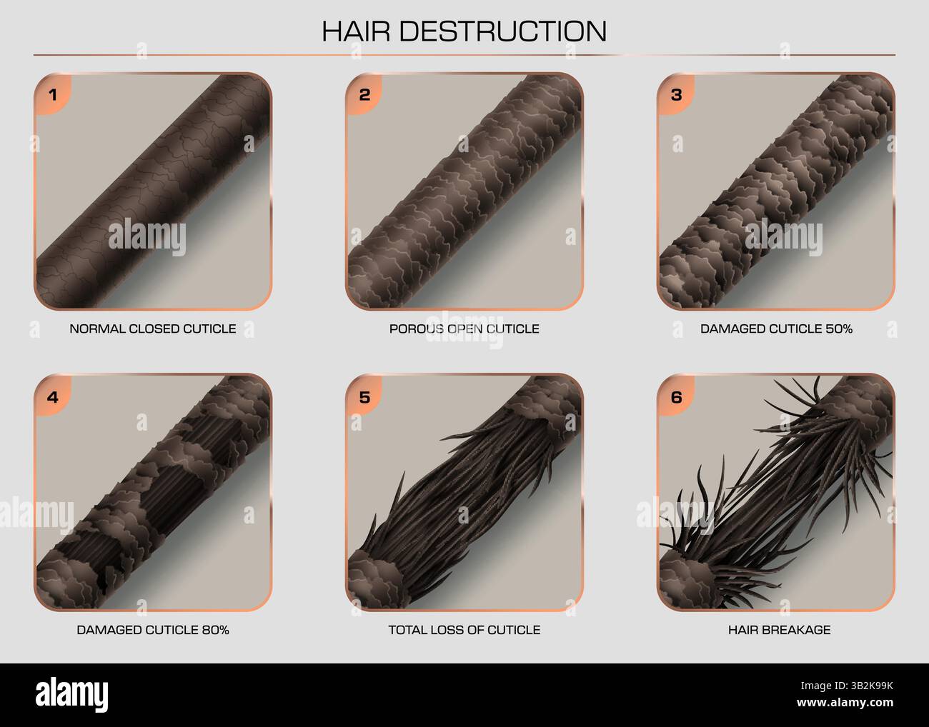 Hair damage and breakage showing the progressive stages of hair cuticle ...