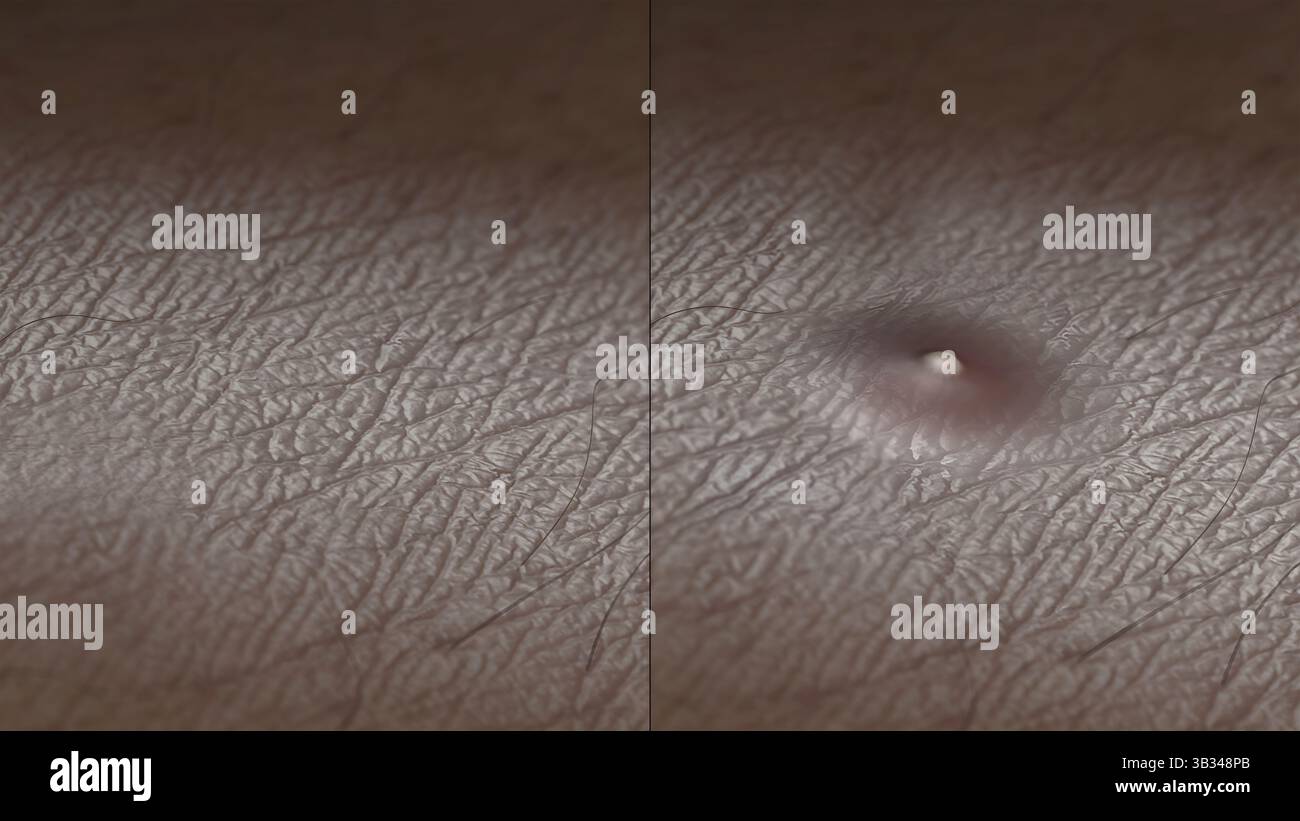 African skin rash hi-res stock photography and images - Alamy