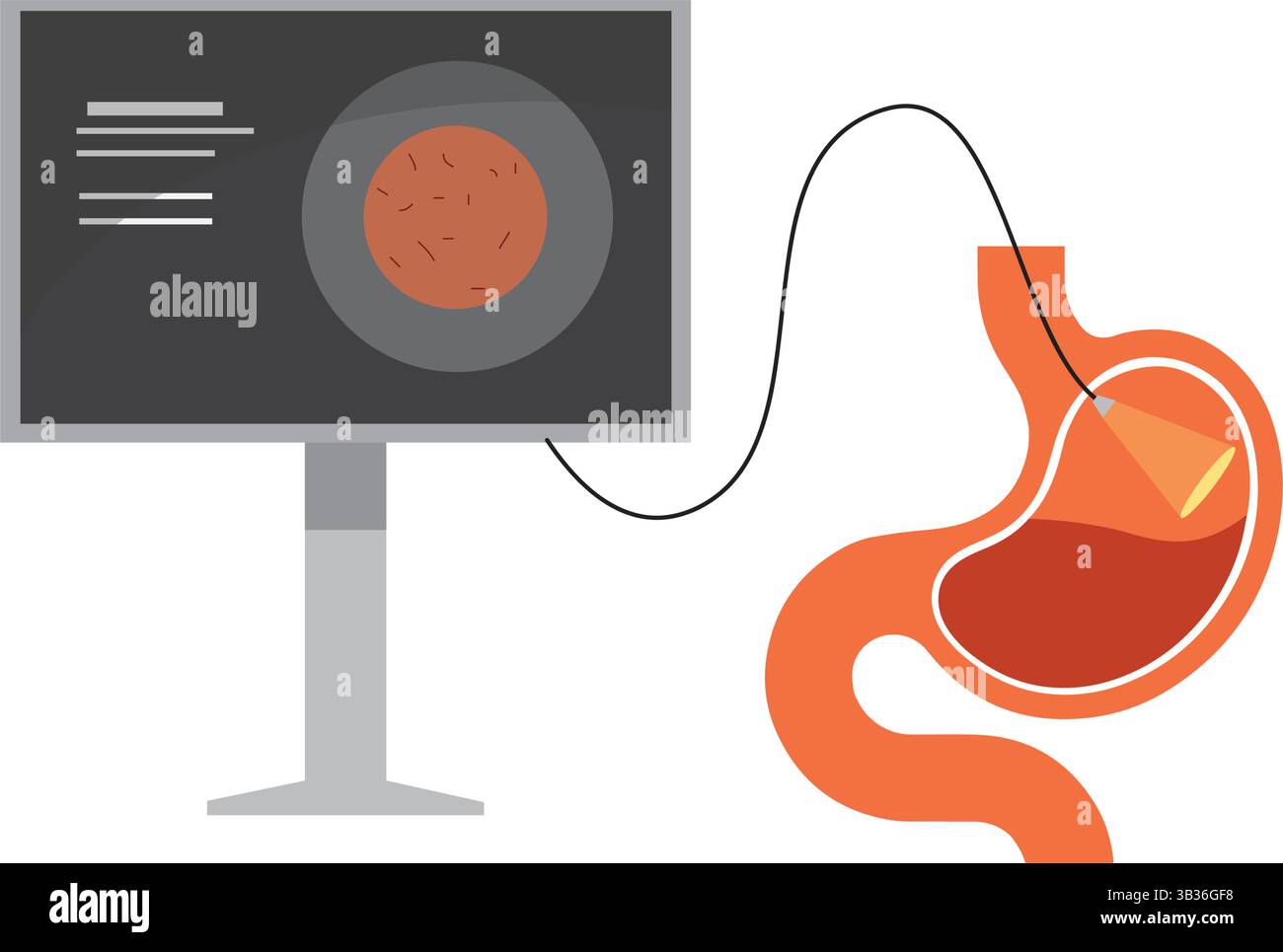 Endoscopy logo icon. Stomach gastroscopy cartoon gastritis medicine ...