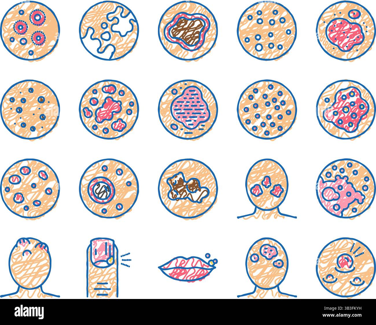 Skin Disease Symptom set Icons hand drawn Stock Vector Image & Art - Alamy