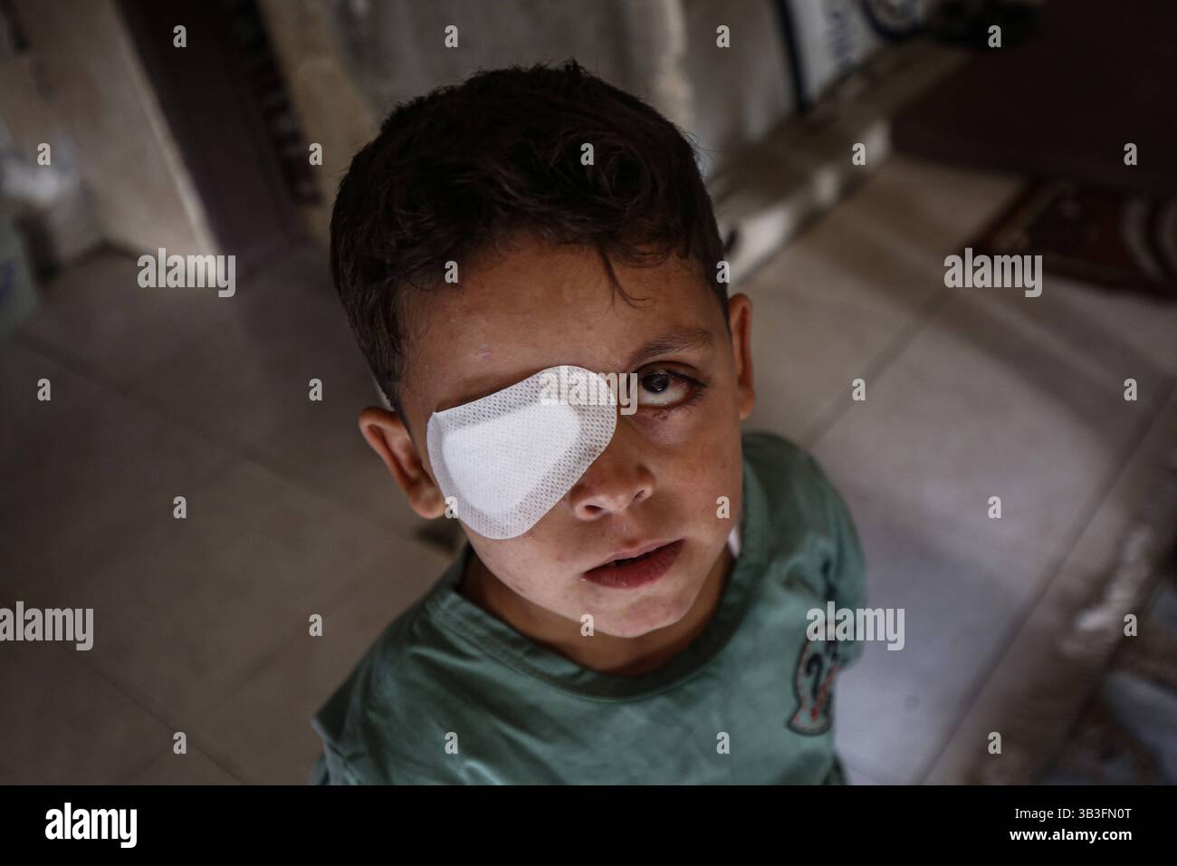A Palestinian child, Mohammad Hijazi 7 years old, is receiving care ...