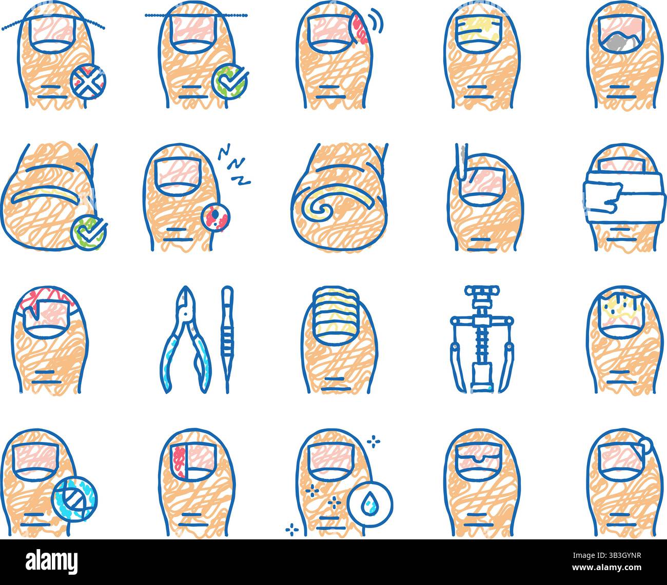 Ingrown nail Cut Out Stock Images & Pictures - Alamy