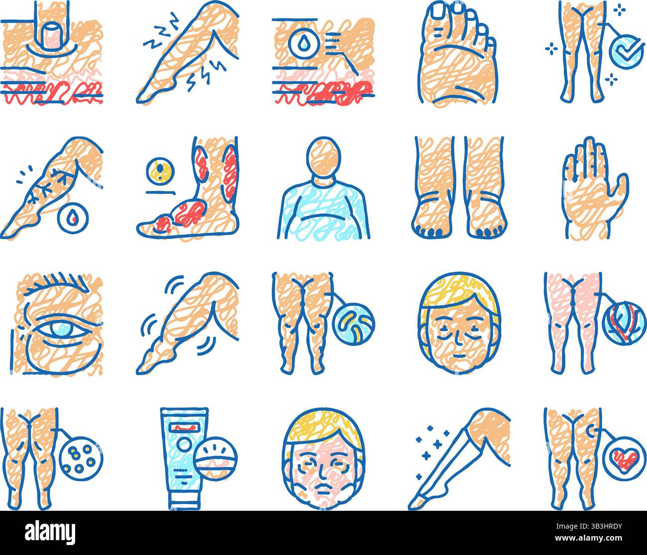 Edema Disease Symptom set Icons hand drawn Stock Vector Image & Art - Alamy
