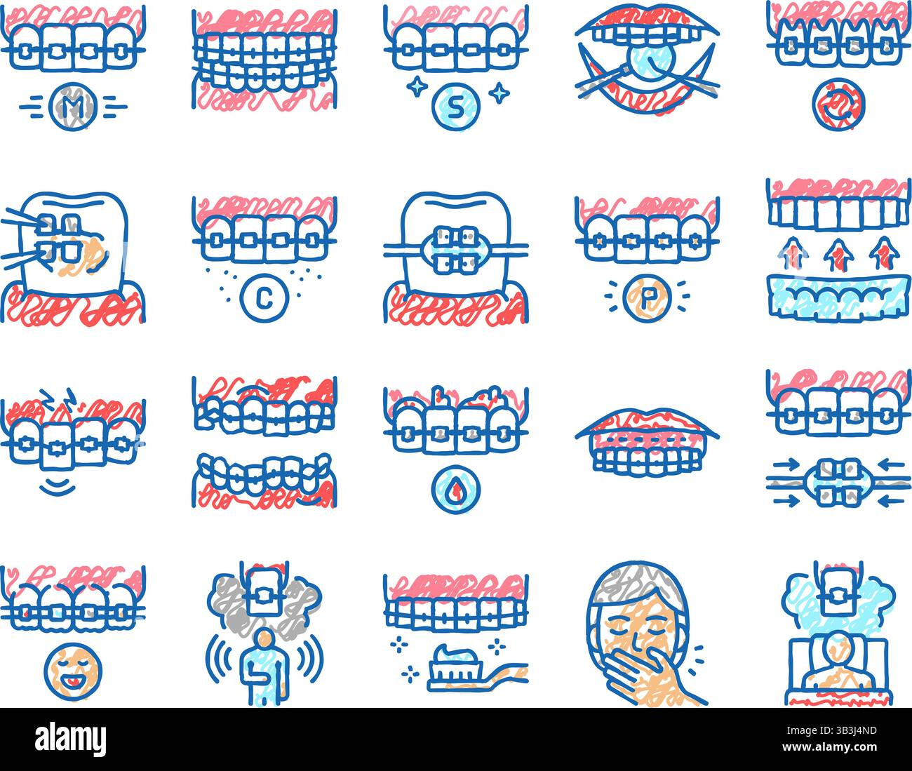 Tooth Braces Accessory set Icons hand drawn Stock Vector Image & Art ...