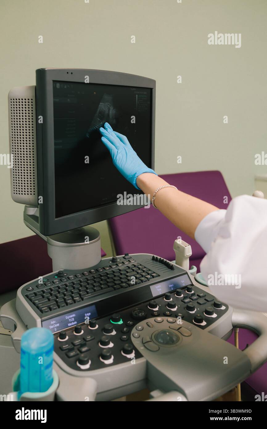 Gynecologist uses ultrasound scanner for gynecology checkup and tells ...