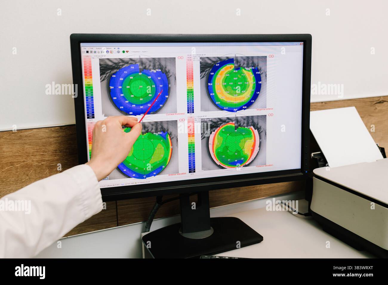 Diagnosis of the cornea and eyes in ophthalmology clinic ...